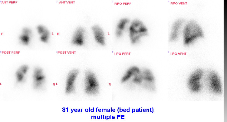 Diagnostic Imaging Ltd, suppliers of SmartVent radioaerosol delivery ...