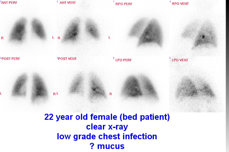 Diagnostic Imaging Ltd, suppliers of SmartVent radioaerosol delivery ...